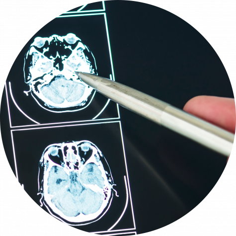 MRI Scans | MRI Scan Centre near me - Aarthi Scans & Labs