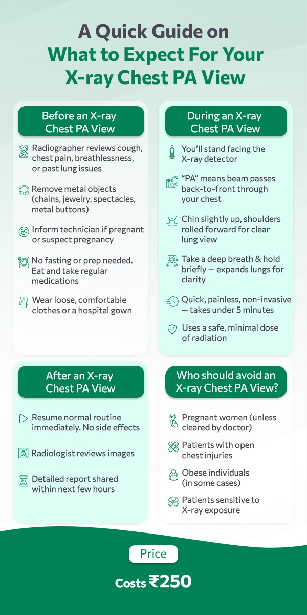 X-ray Chest PA View - Aarthi Scans and Labs